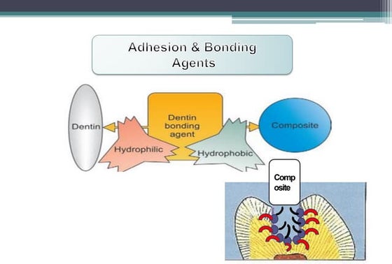 Acid Etching of Enamel and Bond Strength | PPTX