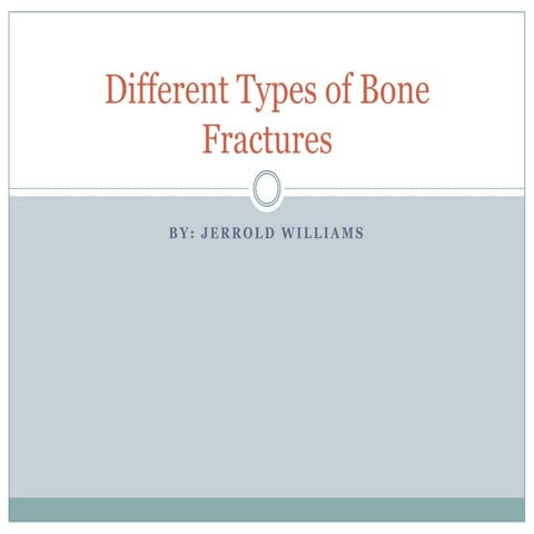 Bone Fractures | PPTX