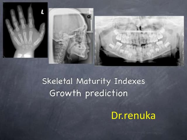 Skeletal maturity index | PPTX