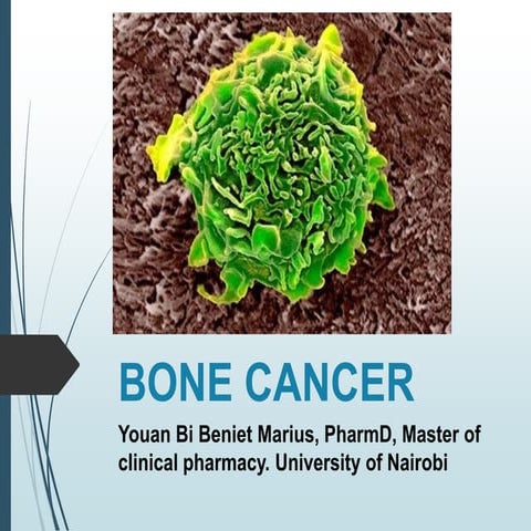Bone Cancer | PDF