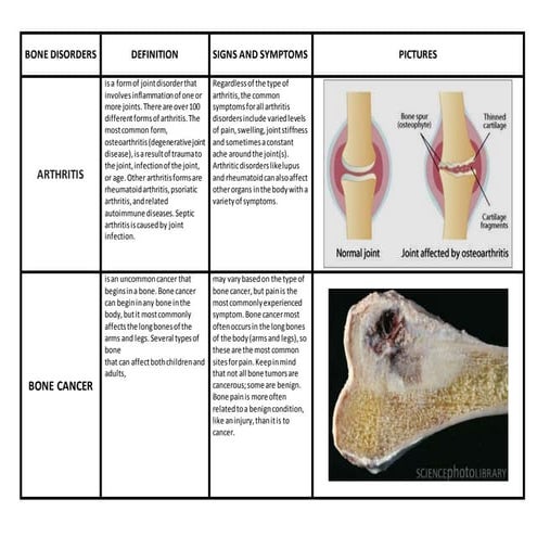 Bone disorders | DOCX