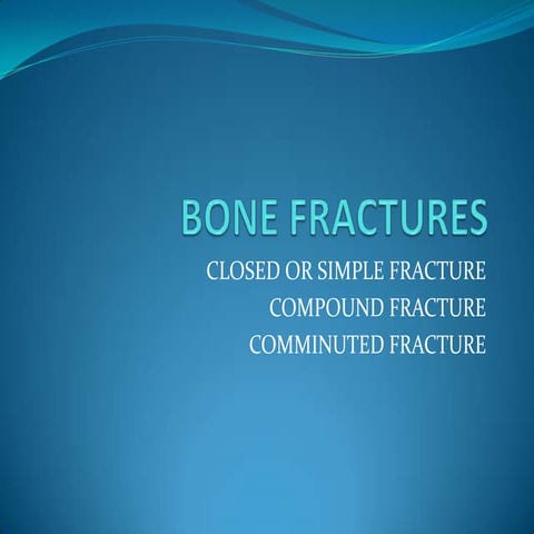 Bone fractures | PPT