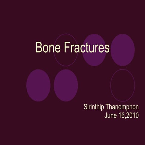 Bone fractures#4presentation | PPT