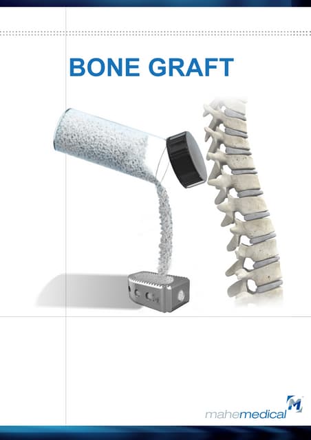 Aplus surgical packs | PPT