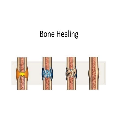 Bone healing | PPT