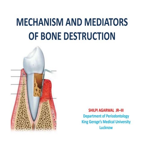 MECHANISM AND MEDIATORS OF BONE DESTRUCTION | PPTX | Bone and Joint ...