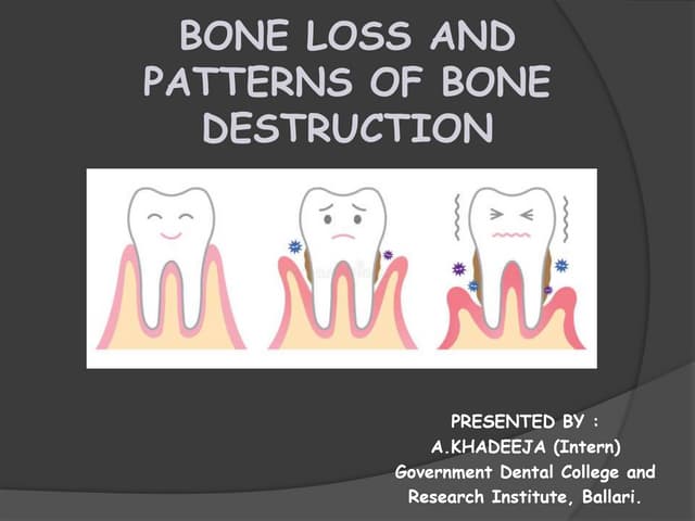 Bone loss and patterns of bone destruction | PPTX