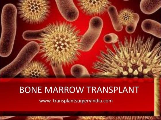 Bone marrow transplant-some facts to know. | PPT