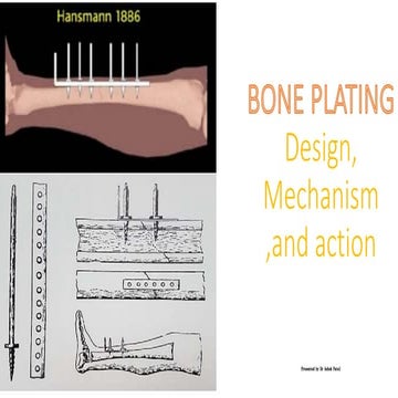 BONE PLATING USES AND COMPLICATION ORTHOPAEDICS PPT | PPTX