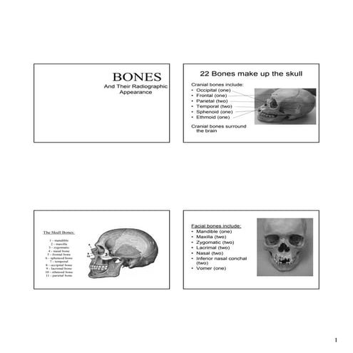 Bones post 11 | PDF