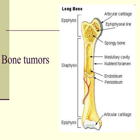 Bone tumors | PPT