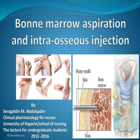 Bonne marrow aspiration and intra osseous injection | PPTX | Bone and ...