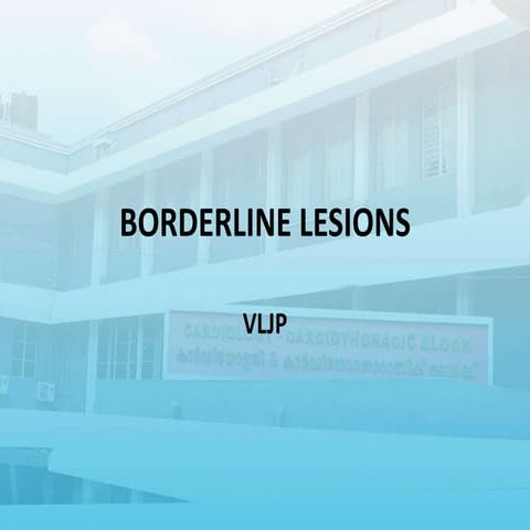 Borderline coronary lesions.pptx