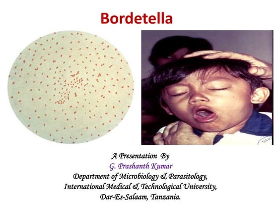 Bordetella | PPT