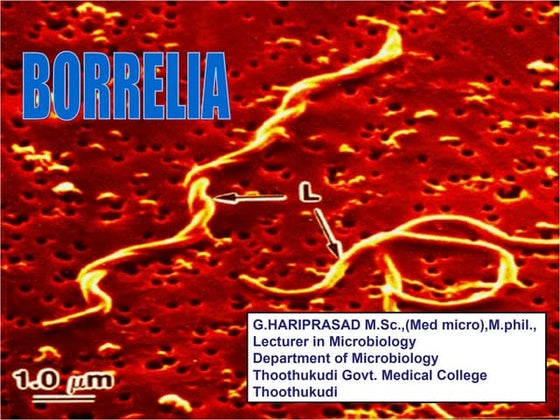 Borrelia | PPT