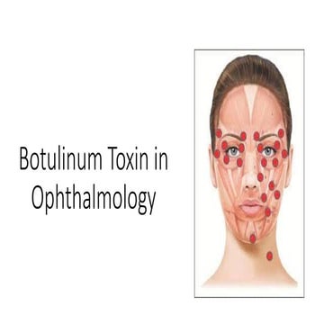 eye presentation sample Botulinum Toxin.pptx