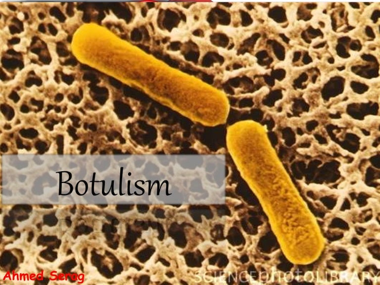 Botulism