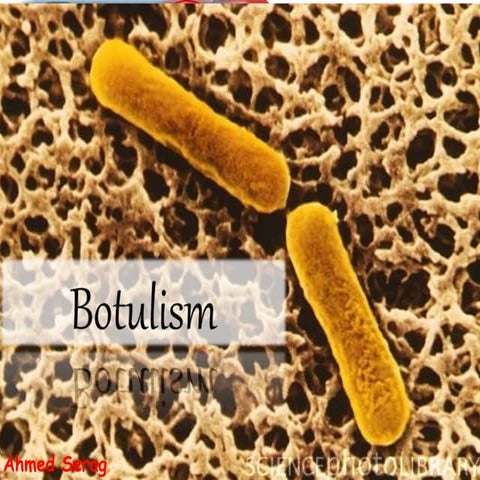 Botulism | PPSX