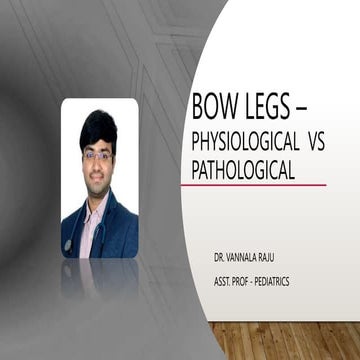 Genu varus and valgus | PPTX
