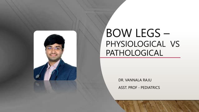 Genu varus and valgus | PPTX