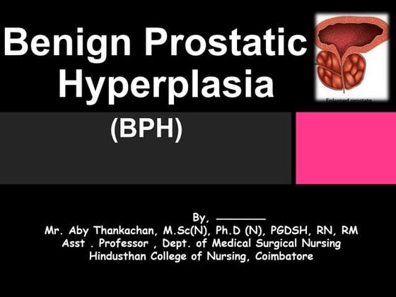 Benign prostatic hyperplasia (BPH) | PPT