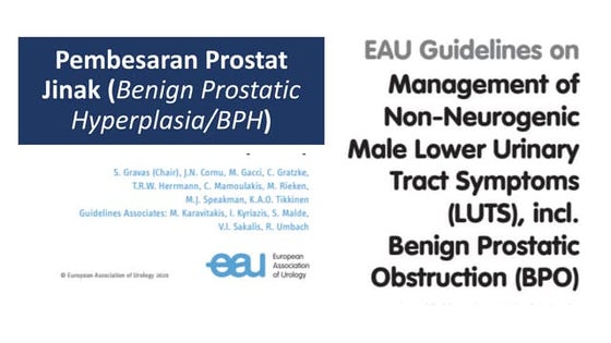 Soal-soal Vignette Benign prostat hiperplasia dan Karsinoma prostat.pptx