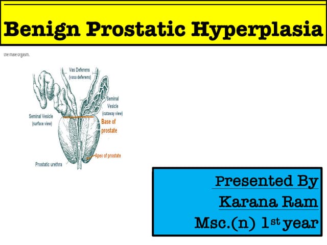 Benign prostatic hyperplasia (BPH) | PPTX