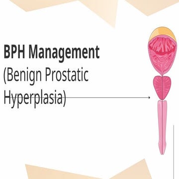 BPH (benign prostatic hyperplasia) in urology | PPTX