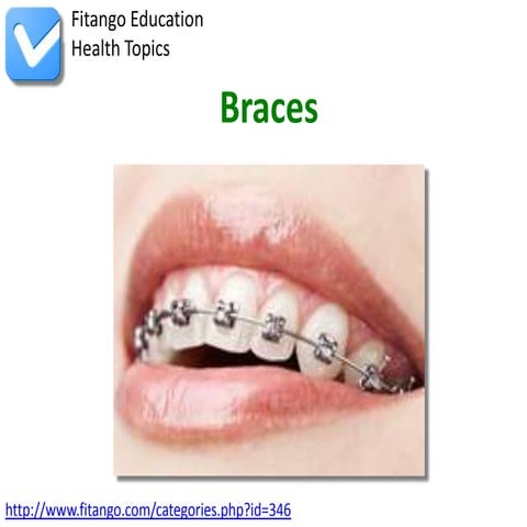 Braces | PPTX