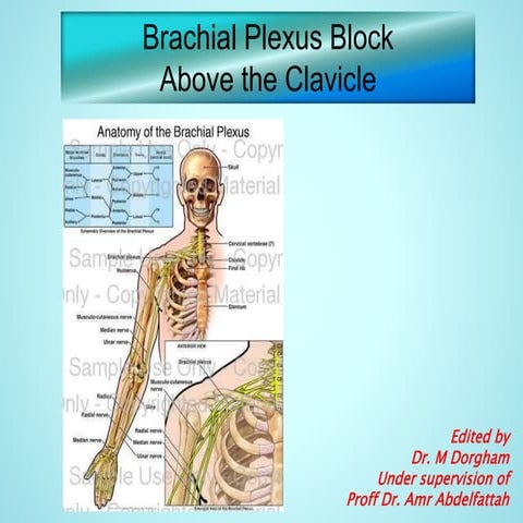 USG GUIDED NERVE BLOCKS PEC 1 PEC 2 BLOCK | PPTX