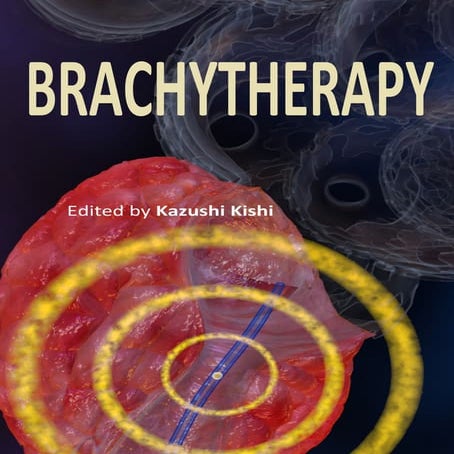 Brachytherapy Kazushi Kishi.v2012-11.pdf