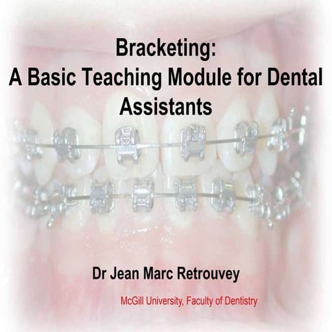 Bracketing for dental assistants | PPT