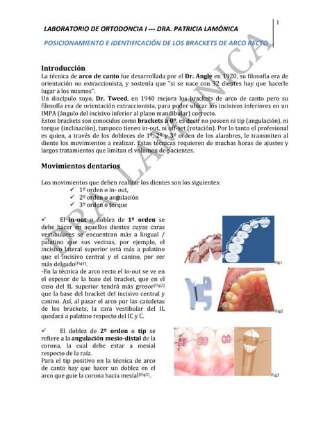 Curso continuado de ortodoncia con filosofia roth williams | PDF