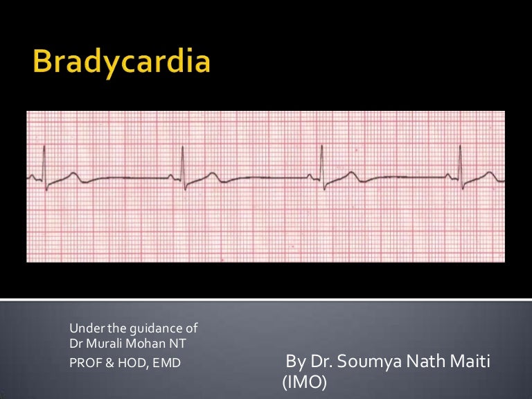Bradycardia