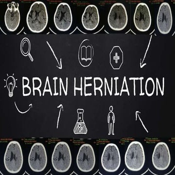 Brain herniation | PPT
