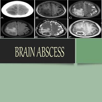 brain abscess causes, risk factors, medical management | PPTX