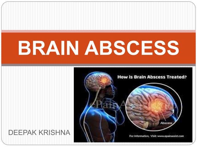 BRAIN ABSCESS.pptx