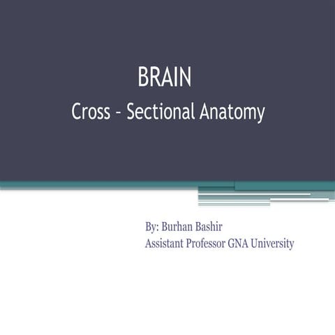 Brain Anatomy cross-sectional for radiology students | PPTX