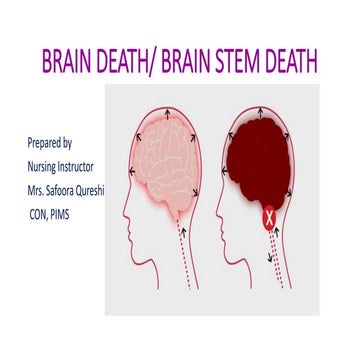 BRAIN DEATH | PPTX