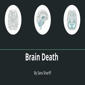 brain death .pptx