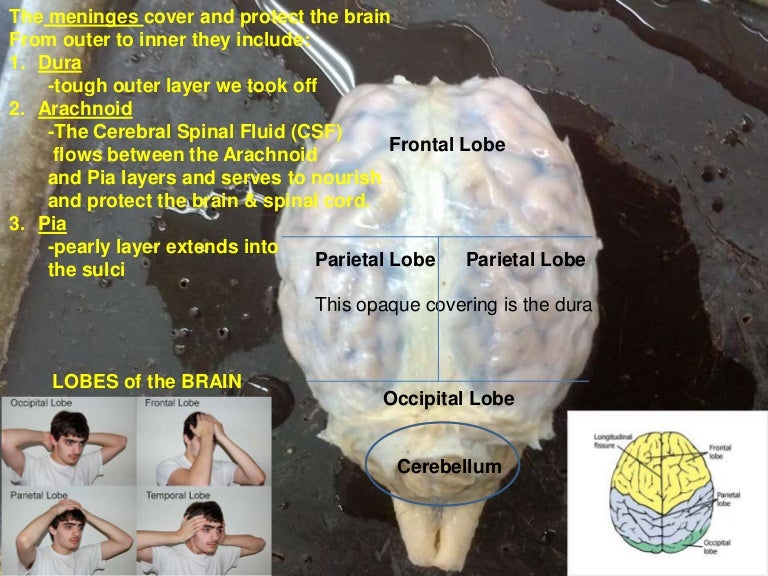 Brain dissection pictures