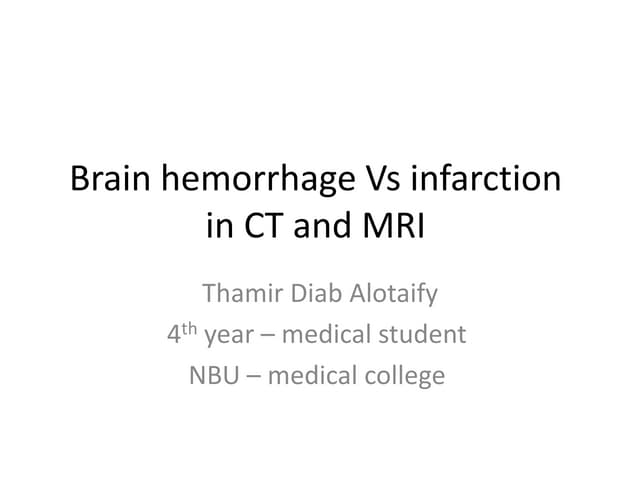 INTRA CRANIAL HEMORRHAGE- AGING BLOOD ON MRI | PPTX