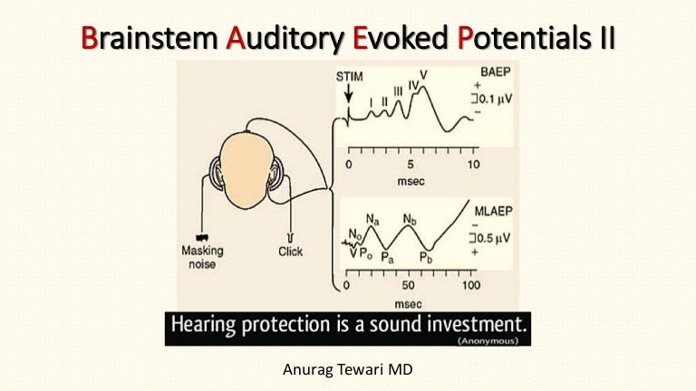 Brainstem Auditory Evoked Potentials Part II