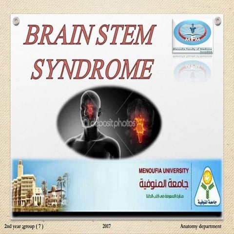 Brain stem syndrome | PPSX