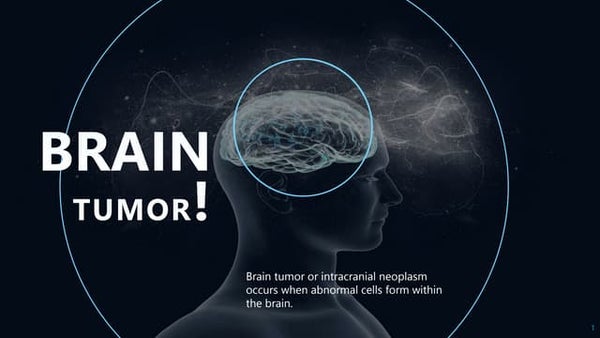 Brain Tumor Detection Using Image Segmentation Ppt