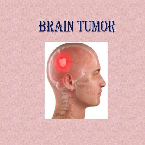 BRAIN TUMOR.pptx kdkd2k2ddk1k2dk1dk1dk2kd | PPT