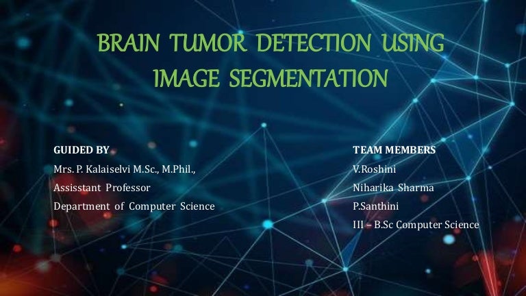 Brain Tumor Detection Using Image Segmentation Ppt 5425