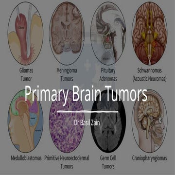 Primary brain tumors and their brief explanation | PPT