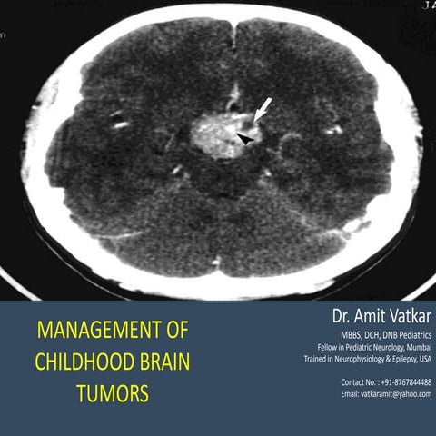 Brain tumor treatment | PPT