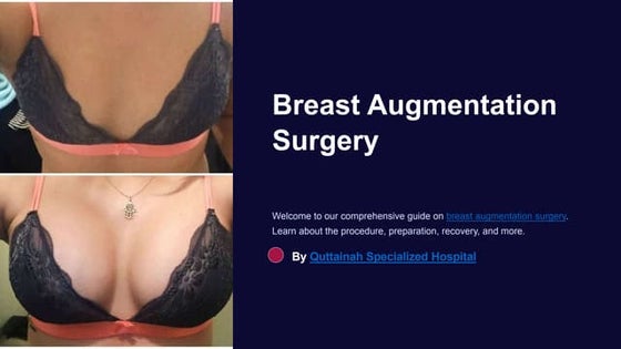 Breast Augmentation Timeline | PPT